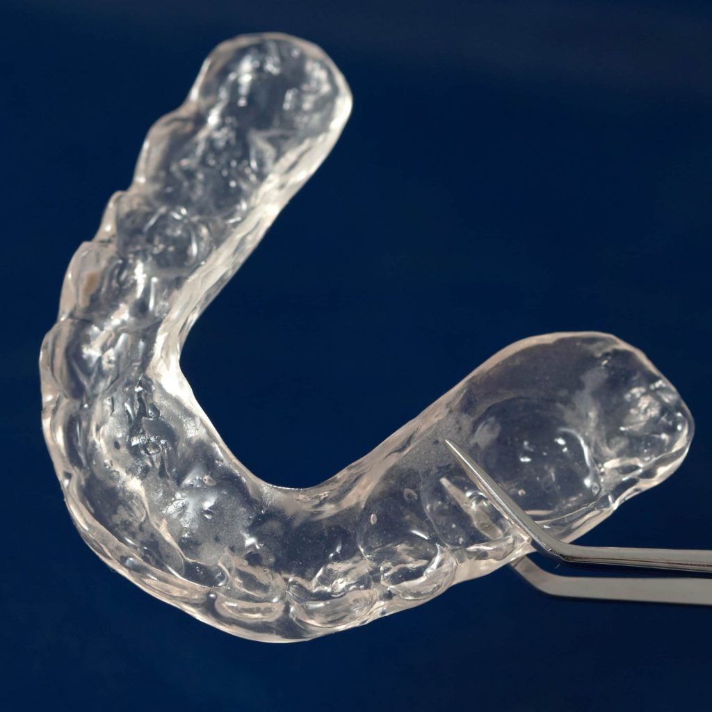 Une plaque occlusale pour prévenir bien des maux | Bücco Orthodontie ...